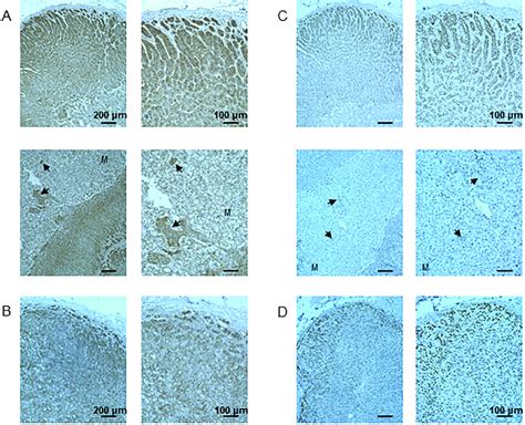 Wnt β catenin pathway is activated in normal human adrenal gland Download Scientific Diagram