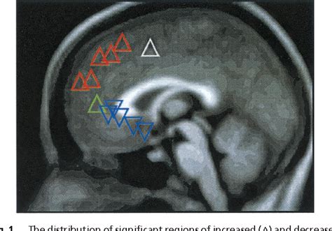 Figure 1 From Medial Prefrontal Cortex And Self Referential Mental Activity Relation To A