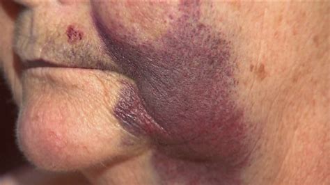 74 Year Old Woman Beaten Robbed In Blitz Attack Outside Fontana Home Suspect Sought Ktla