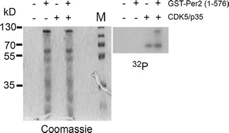Figures And Data In Cyclin Dependent Kinase 5 Cdk5 Regulates The