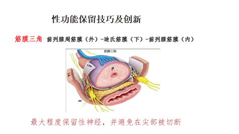 保留性神经前列腺癌根治术（技巧与创新） 张保