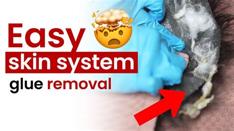 How To Clean Glue Off A Skin Hair System The EASY Way YouTube