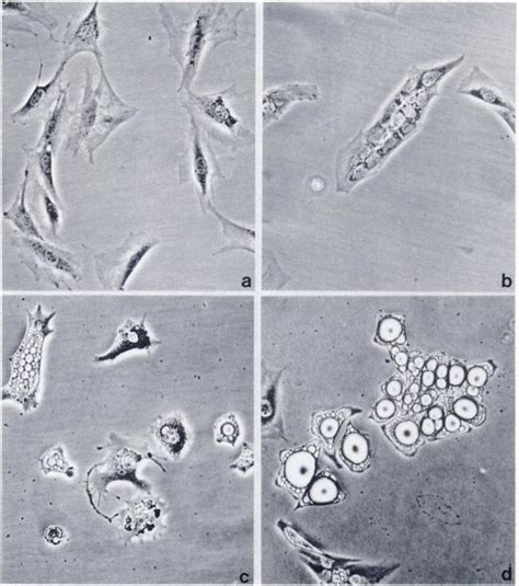 Phase Contrast Micrographs Which Illustrate The Morphology Of Control