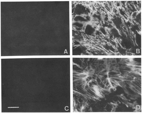 Immunofluorescence Staining For Fibronectin Effect Of Hy Treatment On