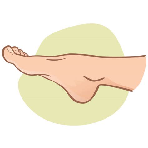 Ringworm Illustrations Royalty Free Vector Graphics And Clip Art Istock
