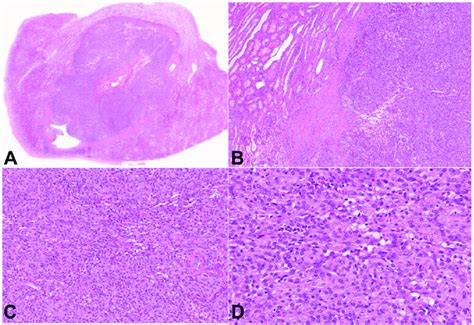Photomicrographs Of The Tumor A Wholemount Showing Cross Section Of