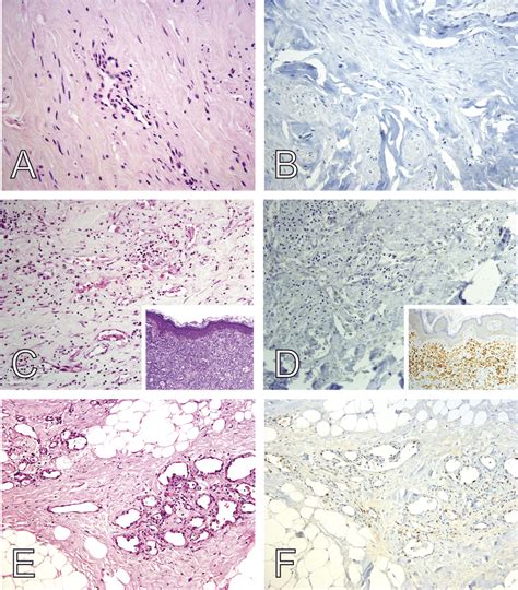 Af Variable Myc Expression In Low Grade Radiation Associated Download Scientific Diagram