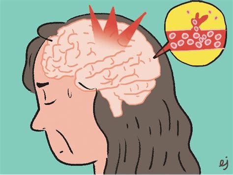 뇌경색 치료 환자 재발 여부 가늠할 길 열리나 네이트 뉴스