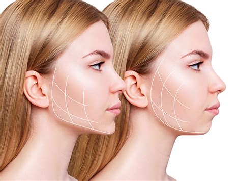 Mandibular Marking The Essential Clinic