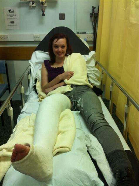 Cast Casted Leg Cast It Cast Long Leg Cast