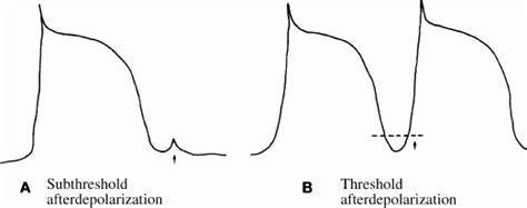 Abnormal Heart Rhythms Thoracic Key
