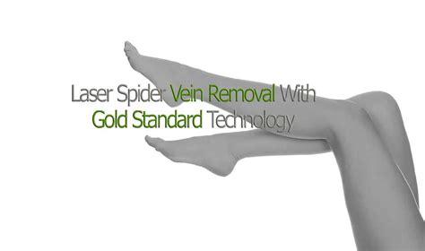 Rosacea Vein Removal Treatment Toronto Bellair Laser Clinic