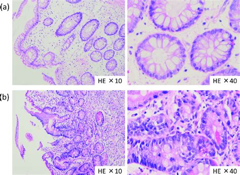 Pathological Findings Of The Gastric And Colon Mucosa We Performed Download Scientific Diagram
