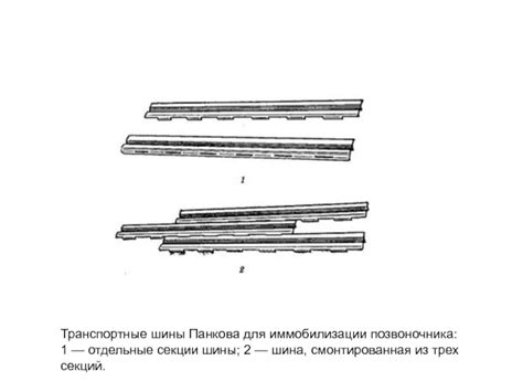Транспортная иммобилизация