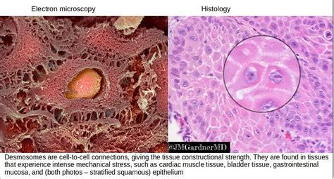 Sofia Pathology Remember Stratum Spinosum Of The Epidermis