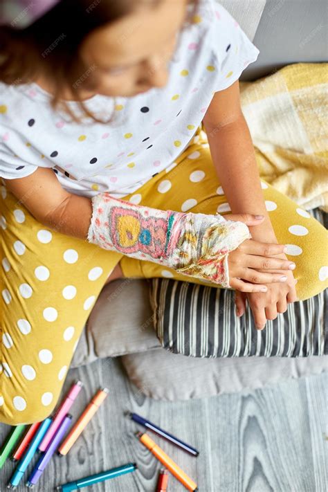 Premium Photo Teen Girl With A Broken Arm At Home An Orthopedic Cast