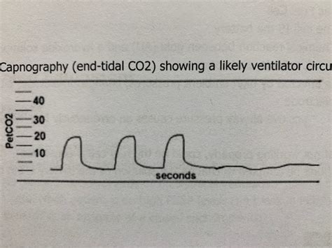 Capnography Flashcards Quizlet