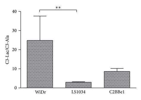 [u 13c]glucose As A Carbon Tracer For Monitoring Glycolysis And Krebs