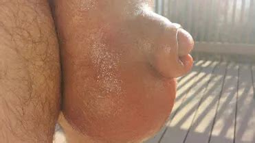 Pumping My Cock And Balls Pics Xhamster