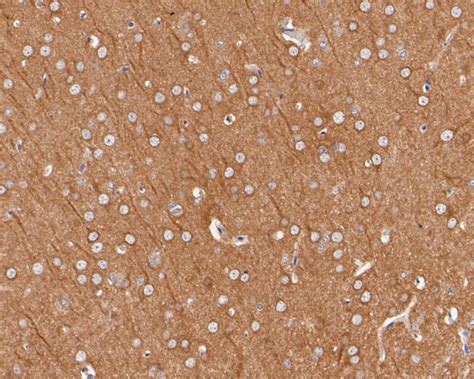 Dynamin 1 Monoclonal Antibody A1b1 Invitrogen 100 μl Unconjugated