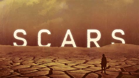 Scars Pastor Jack Hibbs