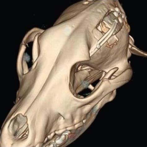 Frontoparietal Decompressive Craniectomy Showing The Balloon And Download Scientific Diagram