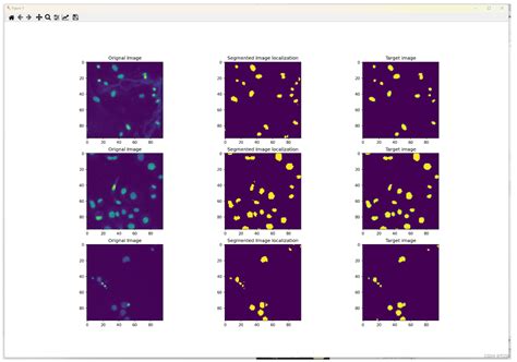 深度学习分割任务——unet分割网络代码详细解读（文末附带作者所用code） Csdn博客