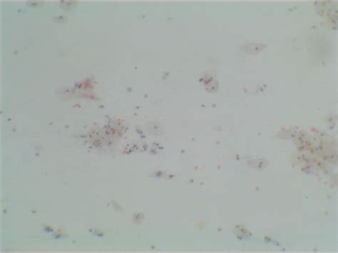 Continuação Mest Object Detection Model By Cervical Ic 2425
