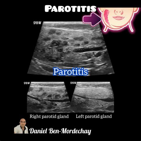 Daniel Ben Mordechay On Linkedin Ultrasound Pocus Radiology