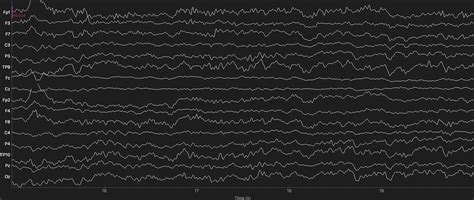 Filtering EEG Data Neural Data Science In Python