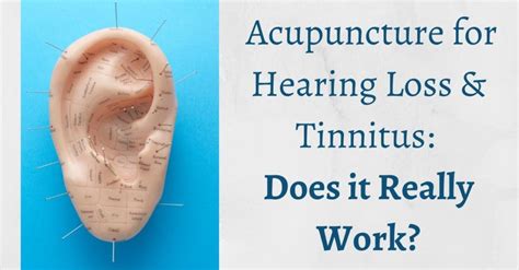 Acupuncture For Hearing Loss And Tinnitus Does It Really Work