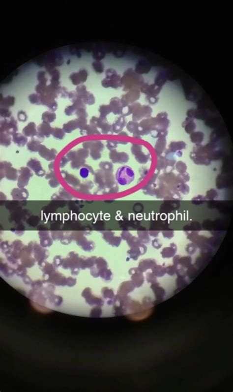 Daniya Khan On Linkedin Mircoscopy Immunesystem Cellbiology