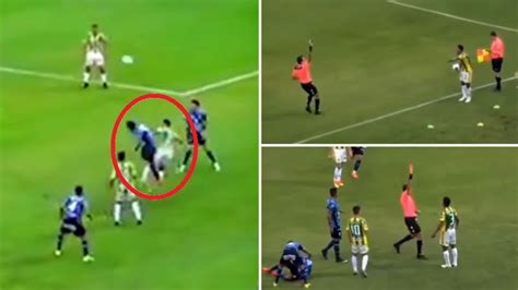 Jugador Sufre Una Fractura De Cráneo Por Un Salvaje Codazo Del Rival