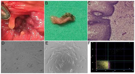 Anal Papillae Pictures Telegraph