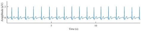 Sensors Free Full Text Driver Fatigue Detection Using Heart Rate