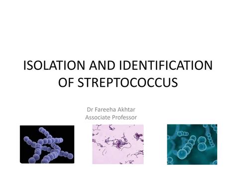 Solution Streptococcal Isolation And Identification Studypool