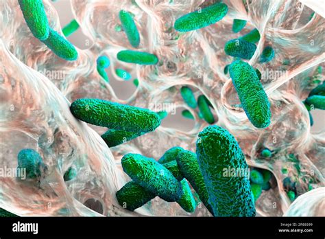 Klebsiella
