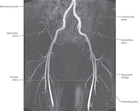 Pelvic Girdle Basicmedical Key