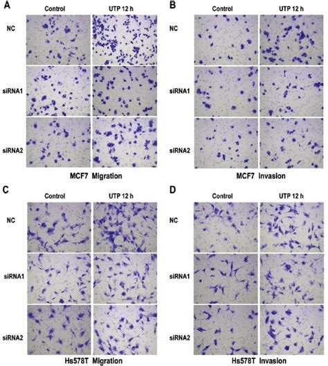 Effects Of P2y2 Receptor Knockdown On Utp Mediated Migration And