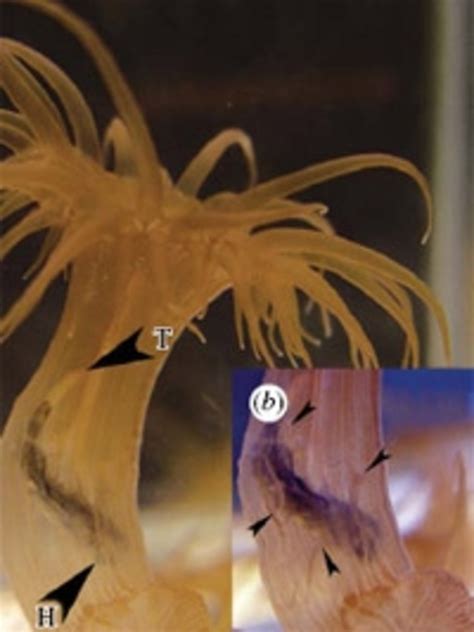 Sea Anemone Anatomy