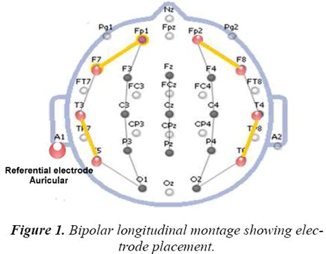 Wavelet Analysis Of Eeg For Seizure Detection Coherence And Phase Synchrony Estimation