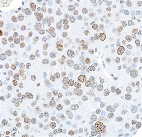 Gamma H2ax Recombinant Monoclonal Antibody Blr053f A700 053