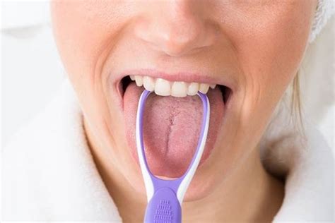 Viral Lidah Seorang Pria Jadi Hijau Dan Berbulu Gara Gara Merokok Ini Fakta Hairy Tongue