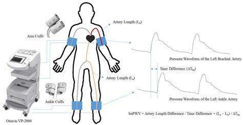 Brachial Artery Pulse