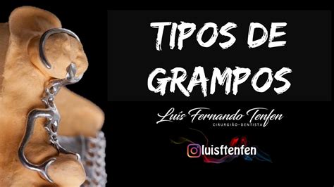 Tipos De Grampos Ppr Braincp