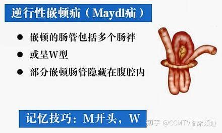 勿以疝小而不为点击带你了解腹外疝 知乎