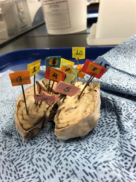 Sheep Brain Sagittal 2 Diagram Quizlet