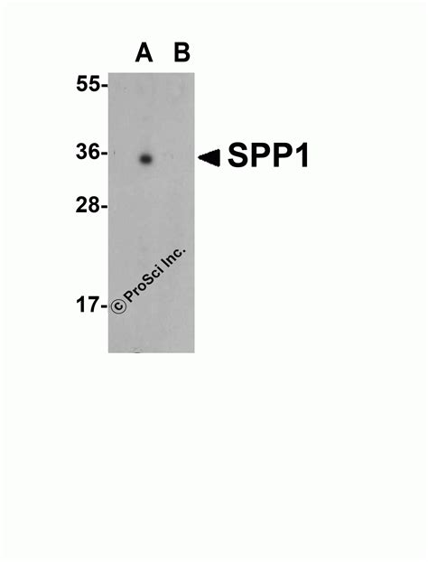 Spp1 Antibody Cat No 7443 Prosci