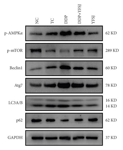 The Effects Of Yfsj On Oxidative Stress Induced Mitophagy In Mouse
