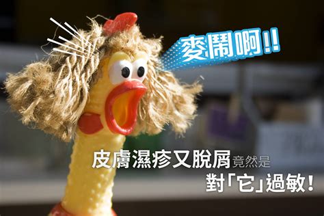 🔺危肌百科🔺肌管局｜麥鬧啊！皮膚 濕疹 又脫屑，竟然是對「它」過敏！ Vanicream薇霓肌本官方購物旗艦店